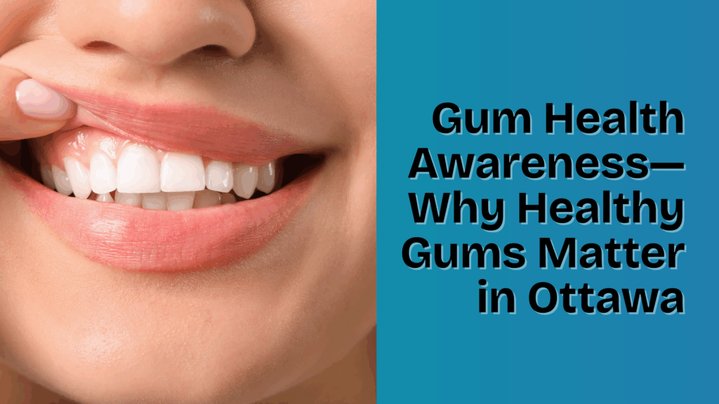 Gum Health Ottawa | Why Healthy Gums Matter